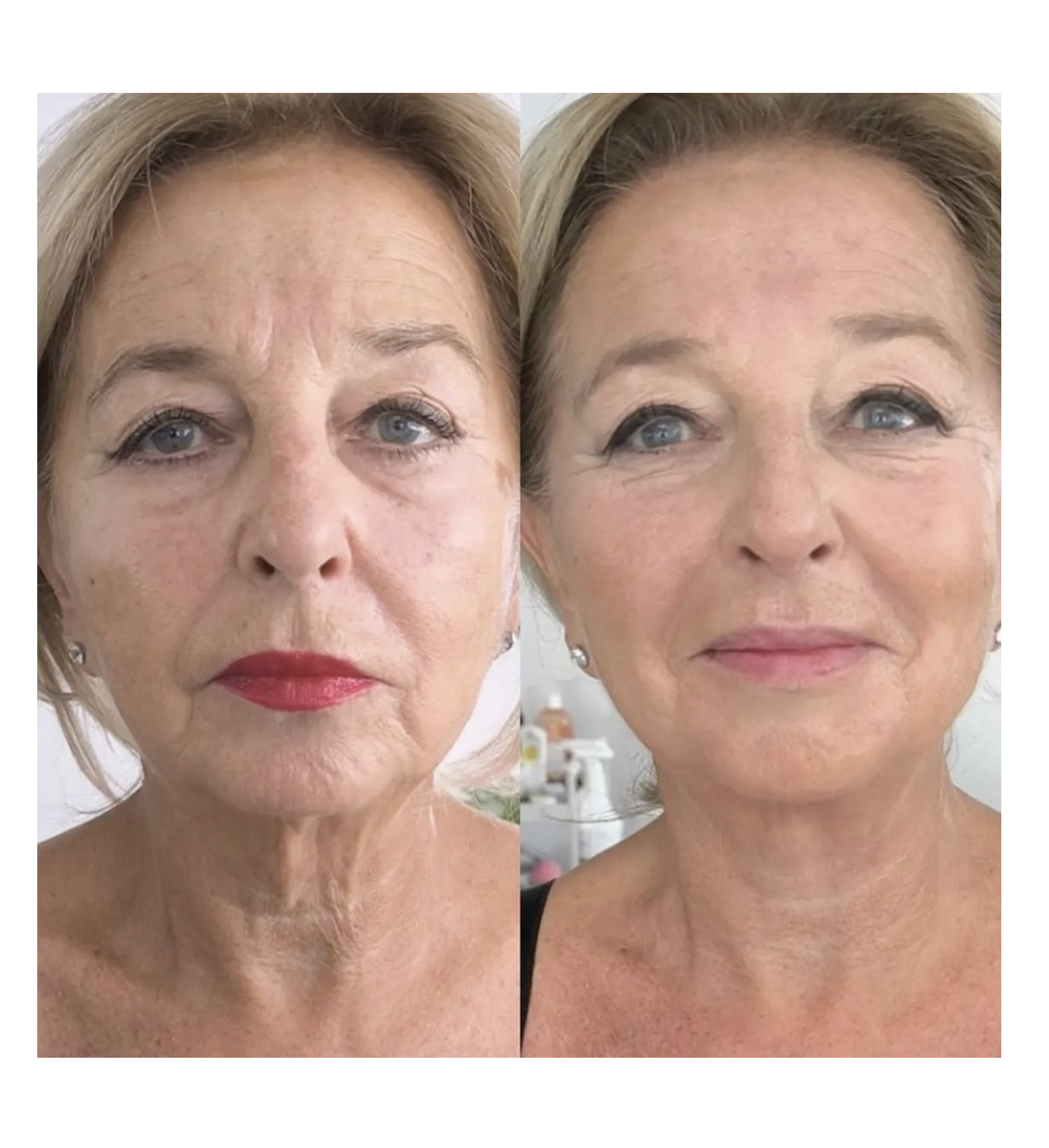 Zoga Face Integration Course